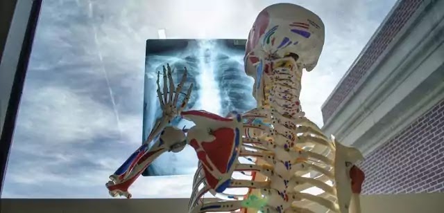 What is X-ray? Explained
