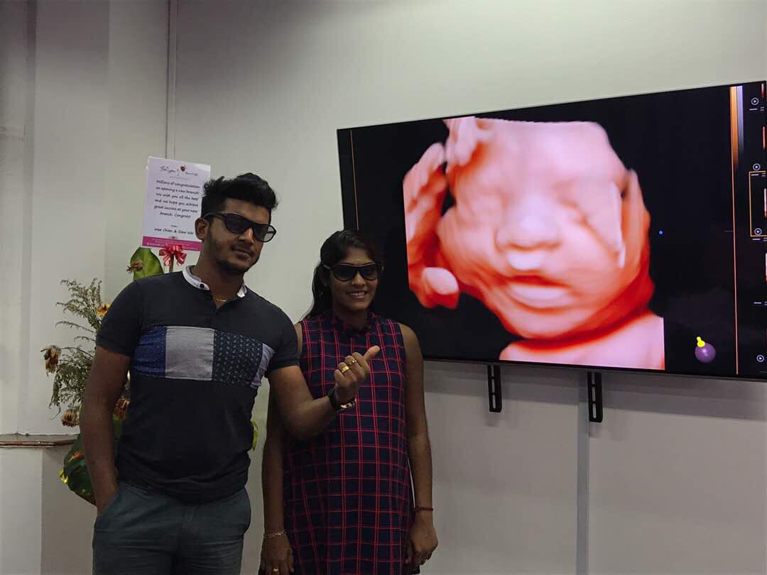 5D 6D SCAN SONOVISION: 3D 4D 5D 6D SCAN @ SONOVISION PENANG GEORGETOWN