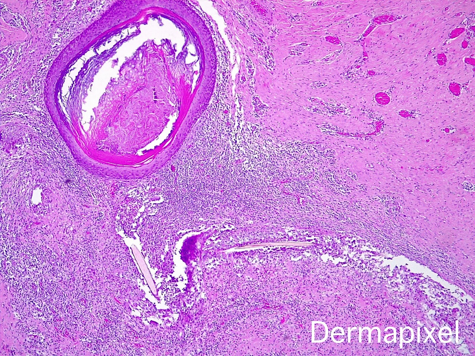 Dermapixel: agosto 2019