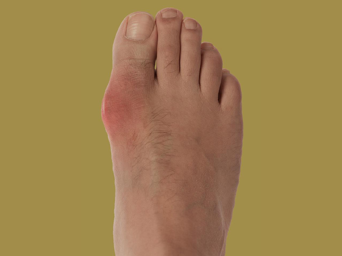 Comment traiter le mal du gros orteil ~ Remèdes Maison