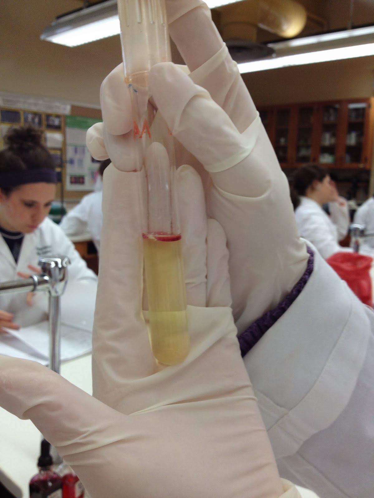 Ari and Johanna's Medical Microbiology Lab Report : Indole, Urea ...