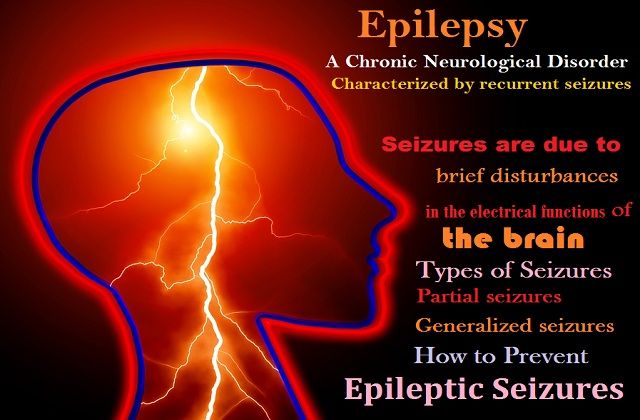 Epilepsy: Symptoms, Causes, and Treatments - How to Prevent Epileptic ...