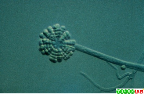 [Parasitology] Atlas of Medically Significant Fungi | Free Medical Atlas