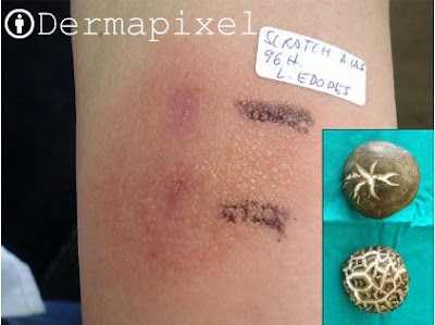 Dermapixel: diciembre 2011