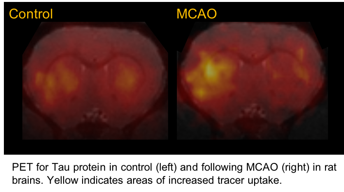 Central Clinical School News Blog: World-first Tau tracer imaging by ...