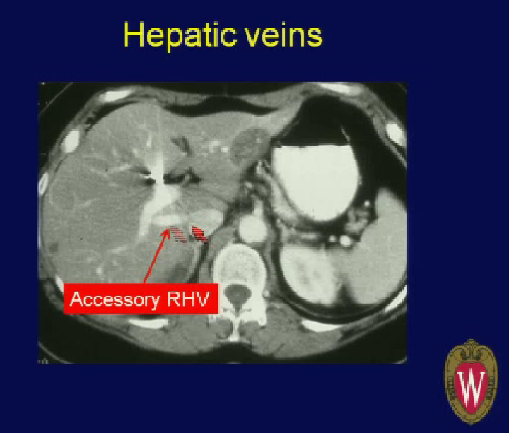 rsna: liver and vascular system