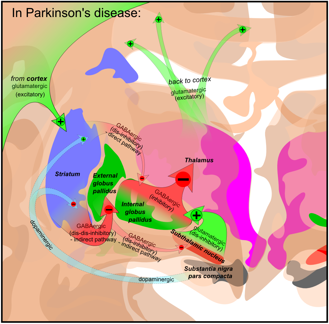 parkinsons - parkinsons disease - parkinsonism - parkinsons symptoms ...