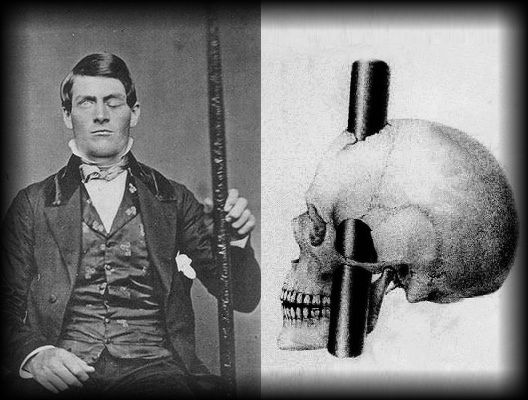 Vermont Dead Line: Phineas Gage