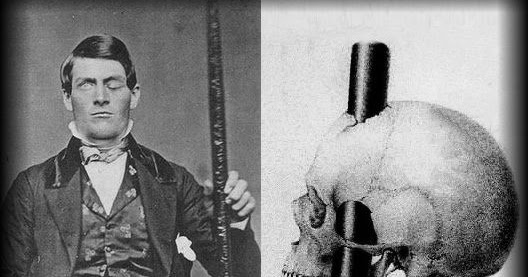 Today in History (Late!): Phineas Gage survives a shocking brain injury ...
