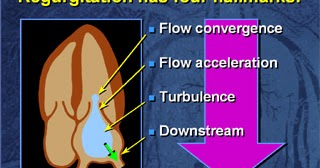 Phimaimedicine: 2,467 การประเมินความรุนแรงของ mitral regurgitation ด้วย ...
