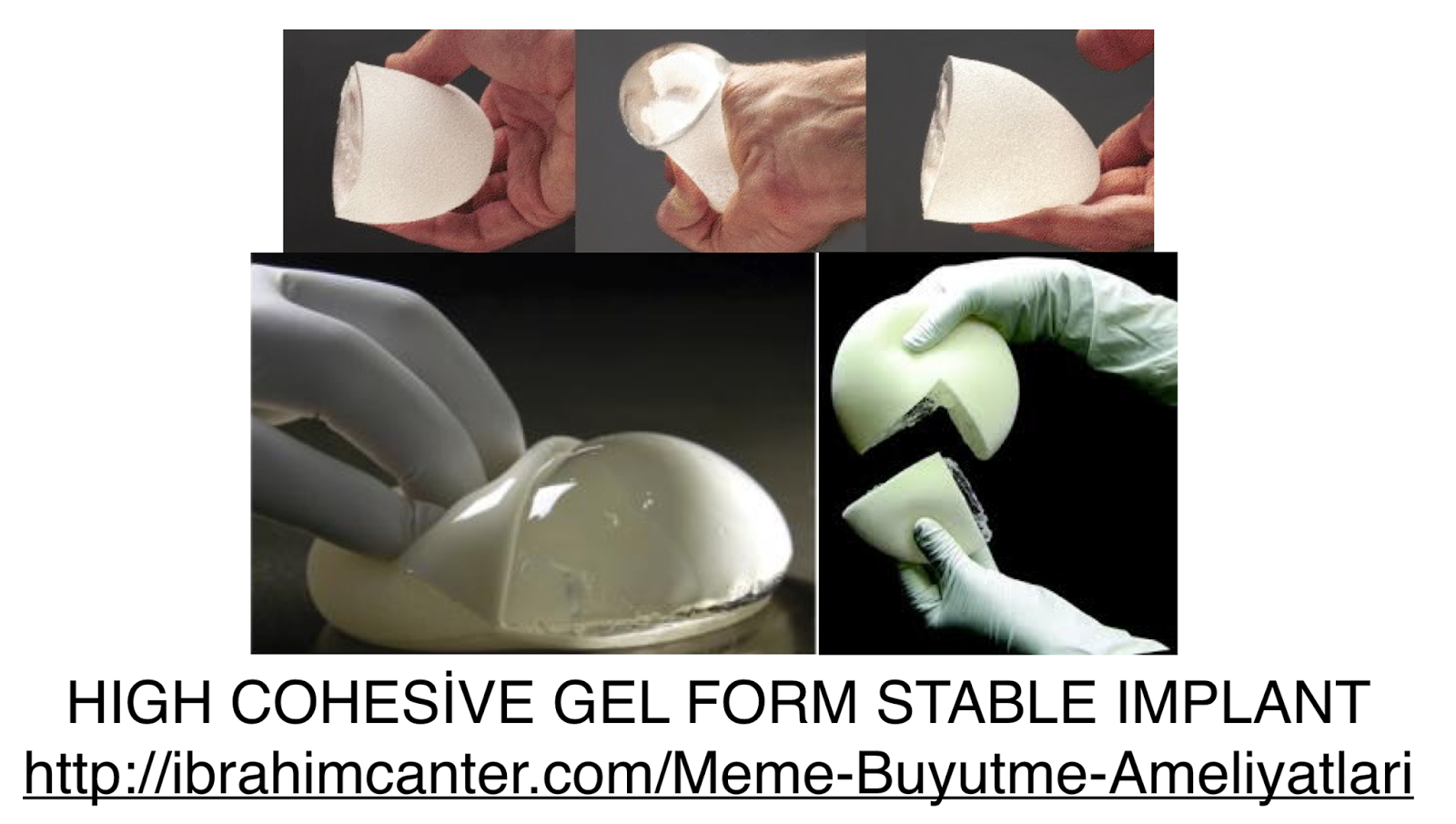 Prof. Dr. Halil İbrahim CANTER: High Cohesive Silicone, Form Stable ...