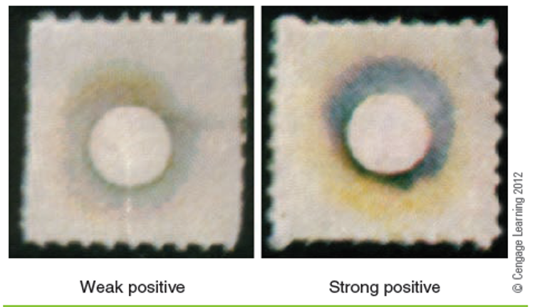 Uji Konfirmasi Pada Tes Urin
