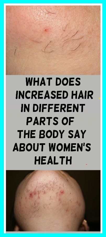 What Does Increased Hair In Different Parts Of The Body Say About Women what-does-increased-hair-in-different-parts-of-the-body-say-about-women