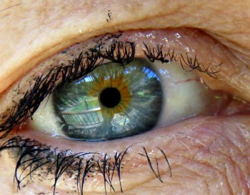 Lessons from the Lamp Post: Lesson 656: Concentric Circles