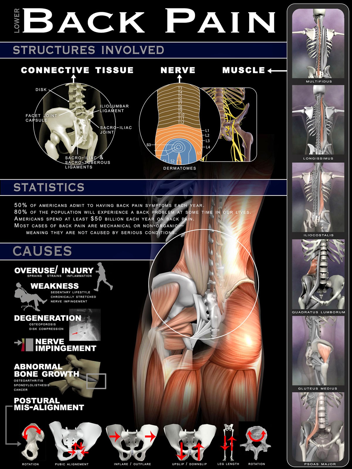 Pain Relief Centre: BACK PAIN: The Structures Involved