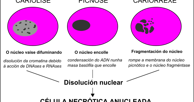 Patologia Geral web: NECROSE