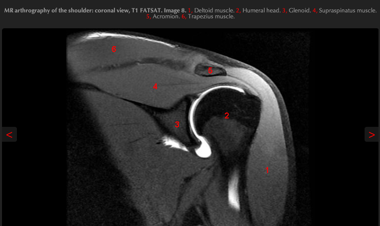 Shoulder and Elbow Surgery: Shoulder Impingement/Rotator Cuff ...