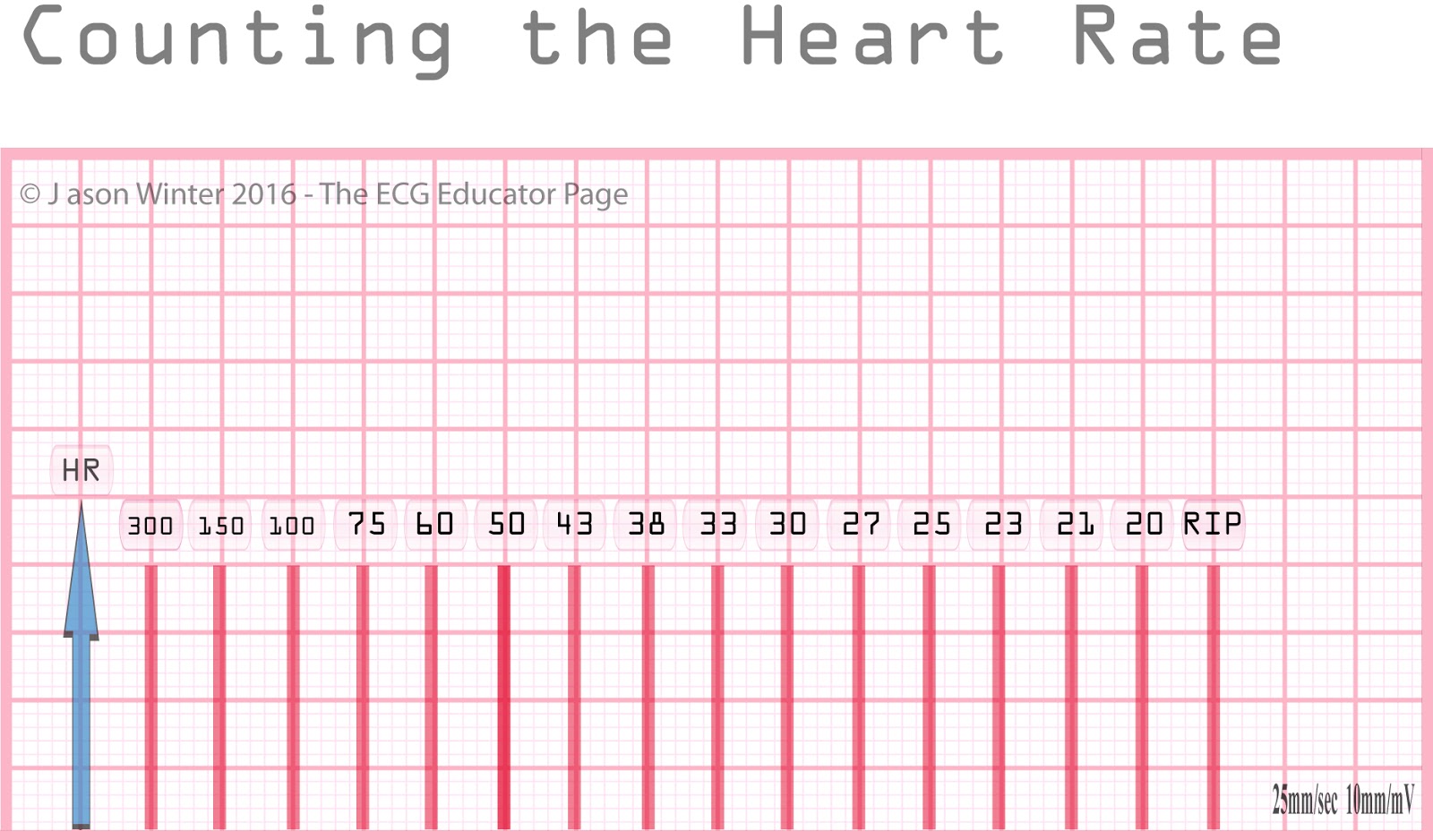 ECG Educator Blog Basic Electrophysiology ecg-educator-blog-basic-electrophysiology