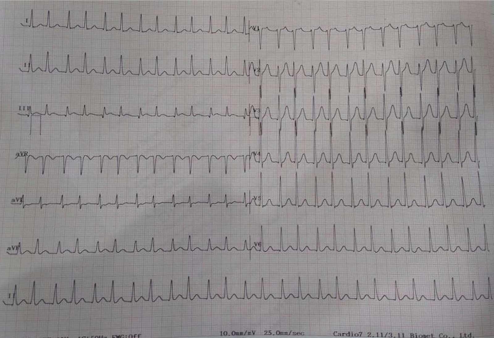 My Other Pages ...: Group Beating SVT Rhythm