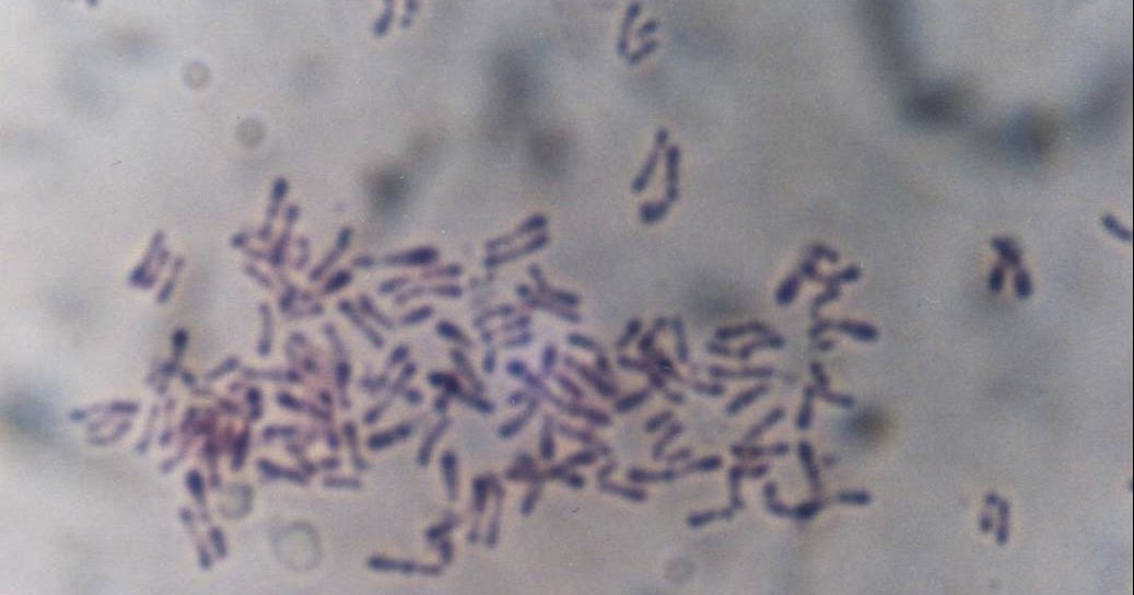 MICROBIOS: DIFTERIA: REVISIÓN Y ACTUALIZACIÓN