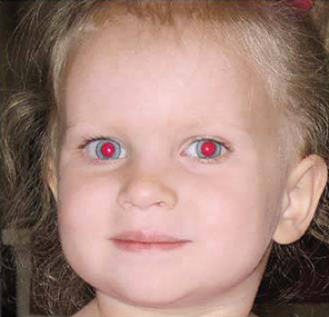 Blog Clase TIC 4: Quitar ojos rojos por el efecto del flash