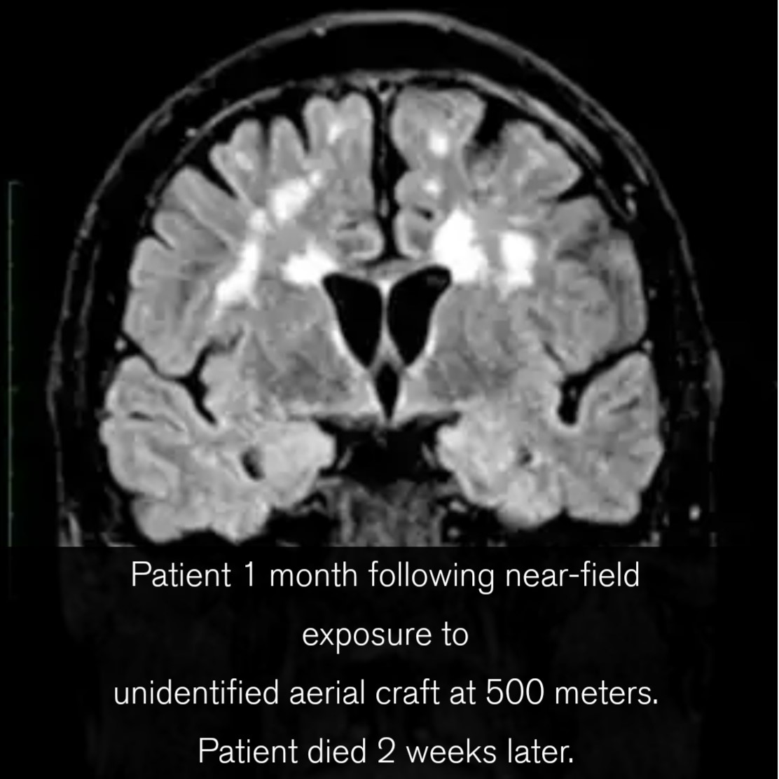 Orbita Cero: Mendoza, Argentina: AAWSAP/AATIP, resonancia magnética ...