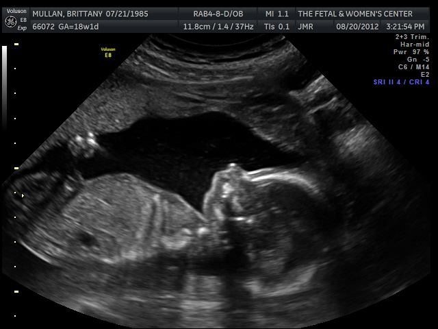 live.laugh.love.baby.: Anatomy Scan