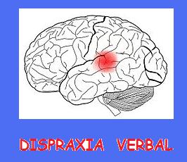 Nuestras cositas de Audición y Lenguaje: Artículo sobre "Dispraxia verbal"