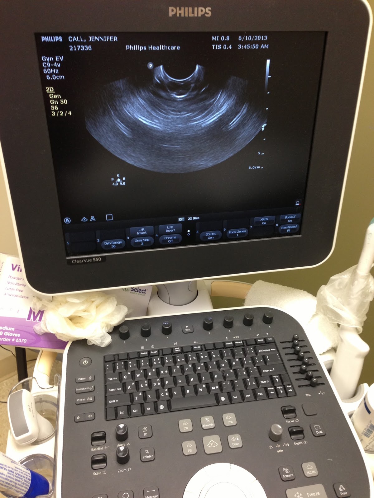 Called: Birth pangs in an empty womb