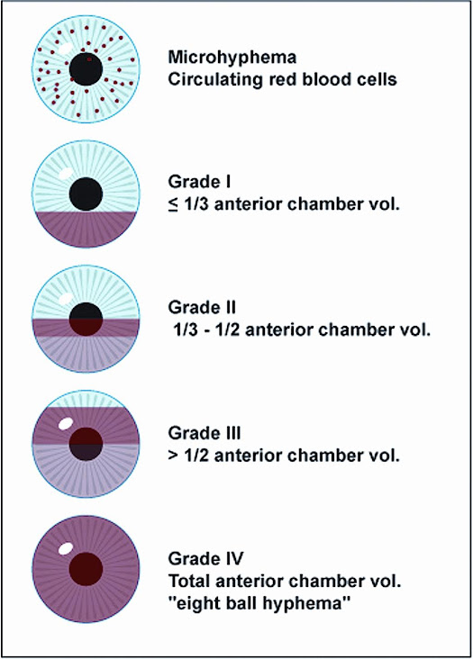 Ophthalmology Notes: Grading & Classification