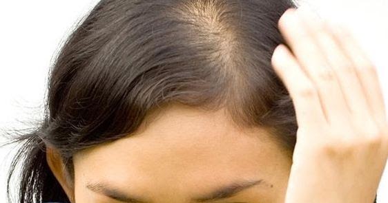 10 Home Remedies for Hair Fall