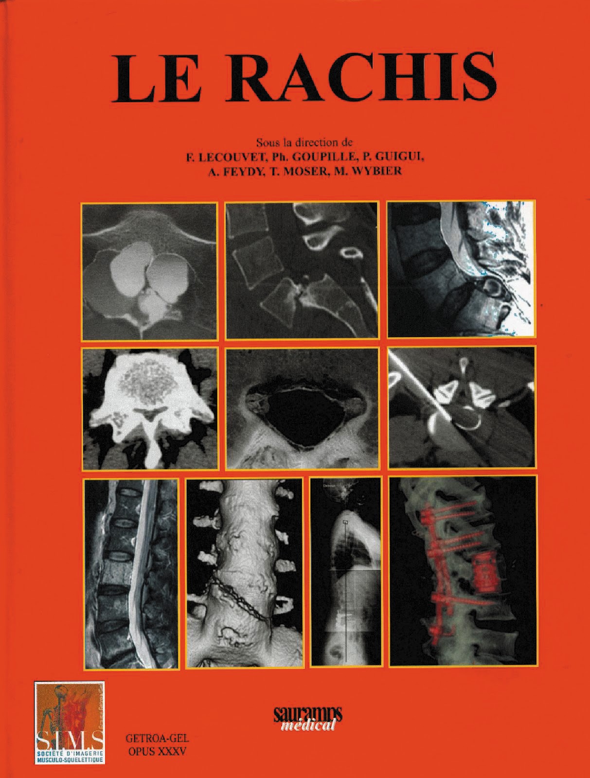 Le Rachis - Best documentation du medecine