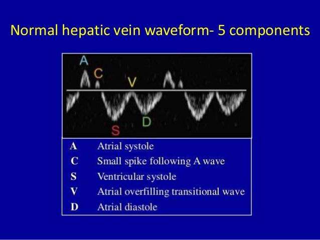 Echocardiography - Normal components of Hepatic Waveform