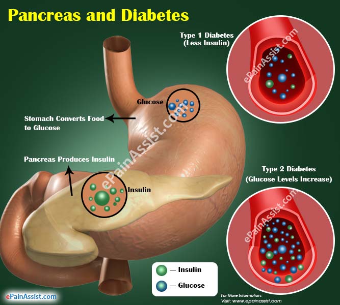 DIABETES REVERSAL REMEDY