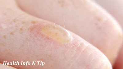 All About Common Skin Disorders