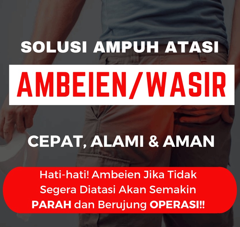 MCS Store | Solusi Wasir/AmbeieN