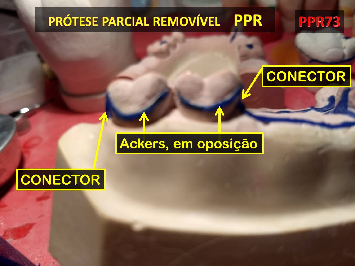 Professor Gilmar Zukowski gilmarprotese.blogspot.com : 3ºANO PPR ...