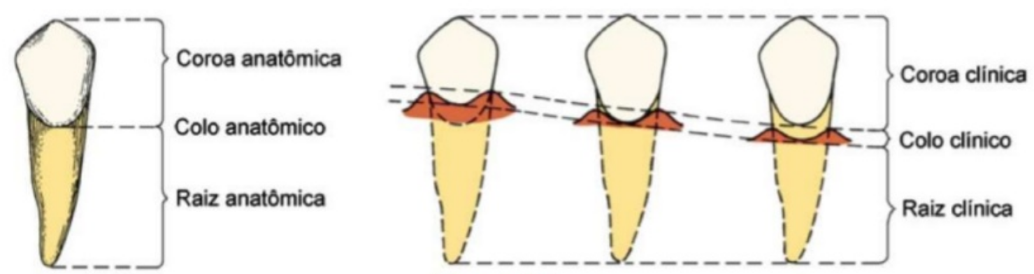 Introdução à Anatomia Dental Parte #1 - Divisão dos Dentes em Faces ...