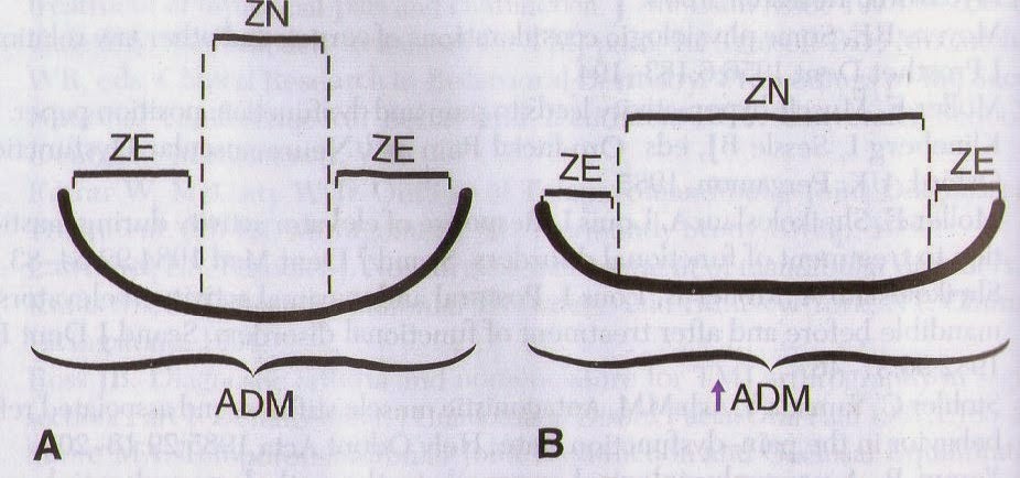 BIOMECÂNICA DO MOVIMENTO HUMANO: ESTABILIZAÇÃO VERTEBRAL CERVICAL