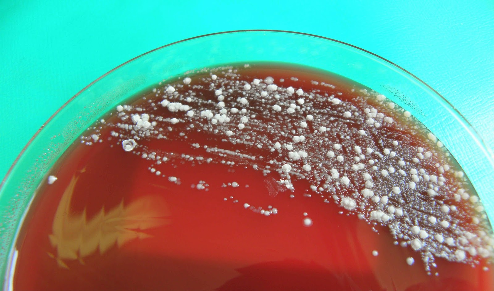 ATLAS MICOLOGIA: MAGNUSIOMYCES CAPITATUS