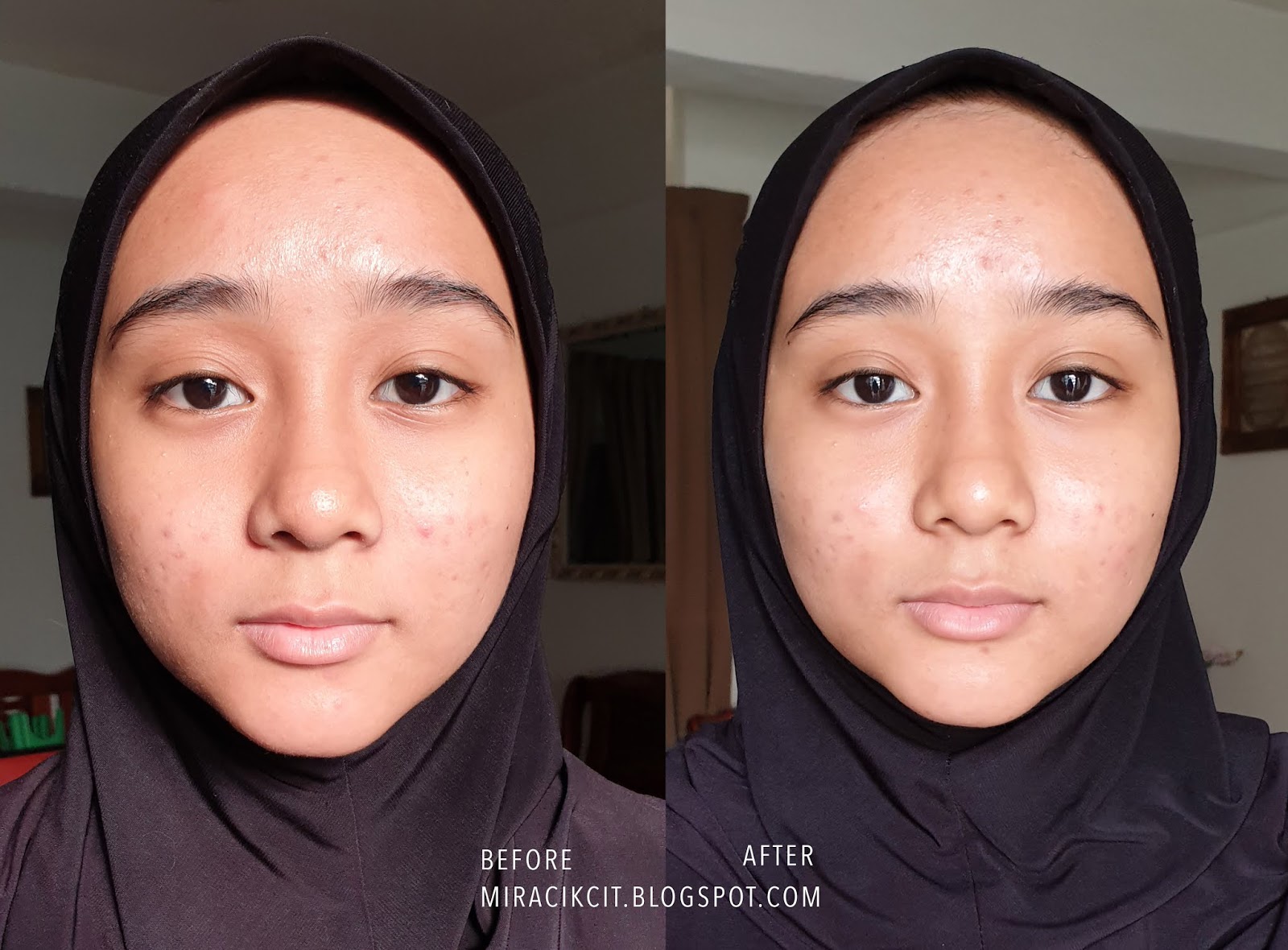 REVIEW: NUVIT MOISTLOC SERIES FOR DRY SKIN — miracikcit
