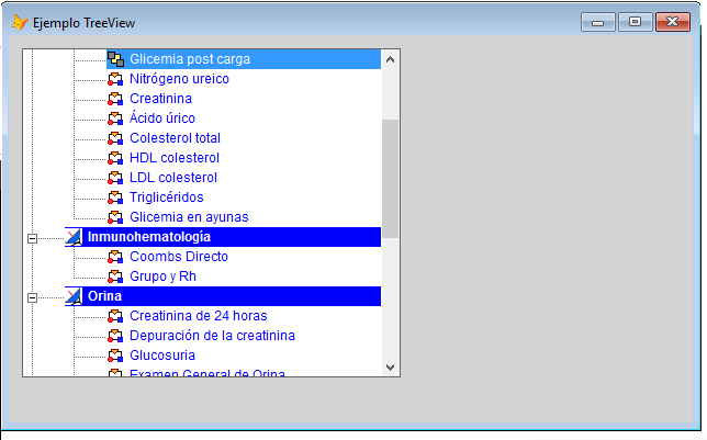 Ejemplos Treeview en VFP ~ Visual Foxpro