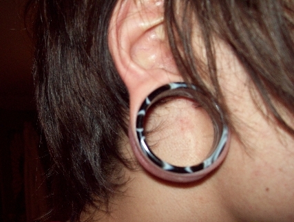 Earlobe Repair Surgery: Know the Potential Risks of Large Stretched Ear ...