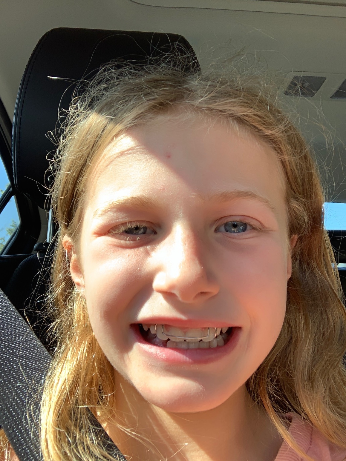 The Life and Times of Matt, Darcy, Ellie, Emily, and Wyatt: Braces Off!