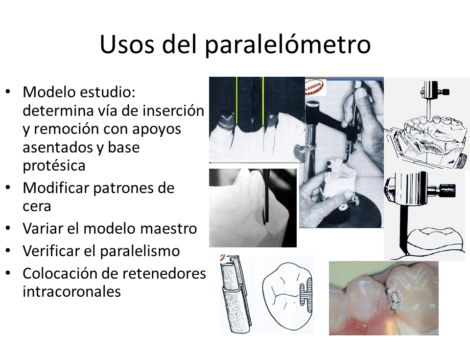REHABILITACION II : 2°° Parcial PARALELOMETRO
