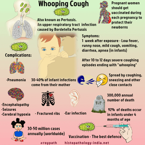The Health Hub: Whooping cough