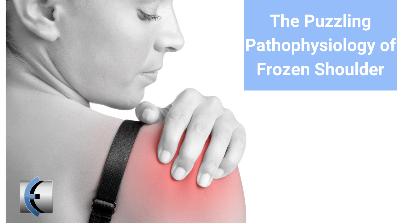 The Puzzling Pathophysiology of Frozen Shoulder | Modern Manual Therapy ...