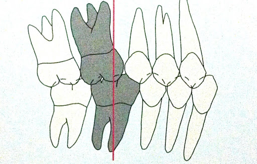 PRIMEIRO MOLAR INFERIOR PERMANENTE - RESUMO COMPLETO