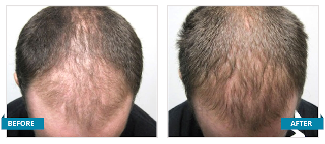 Healthy Hair More Secrets to Beautiful Hair - Your Beauty And Health