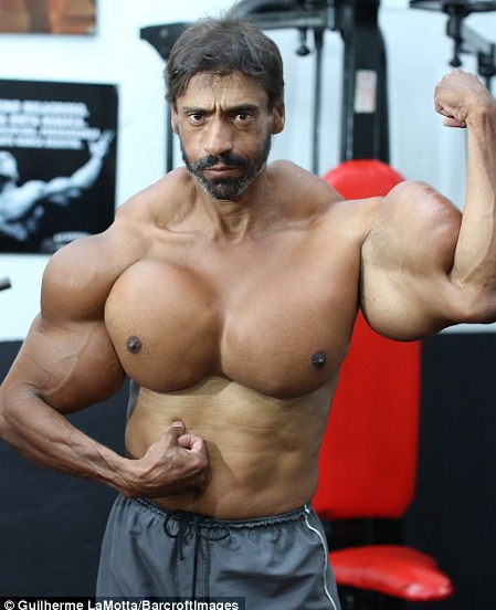 Photos: Brazilian Bodybuilder Injects Oil Into Muscles To Look Like The ...